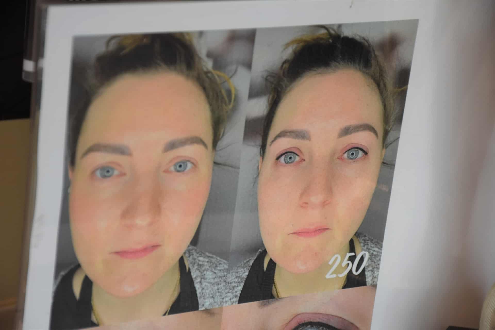 Susanne blev sparket af en indsat og måtte stoppe som fængselsbetjent ...