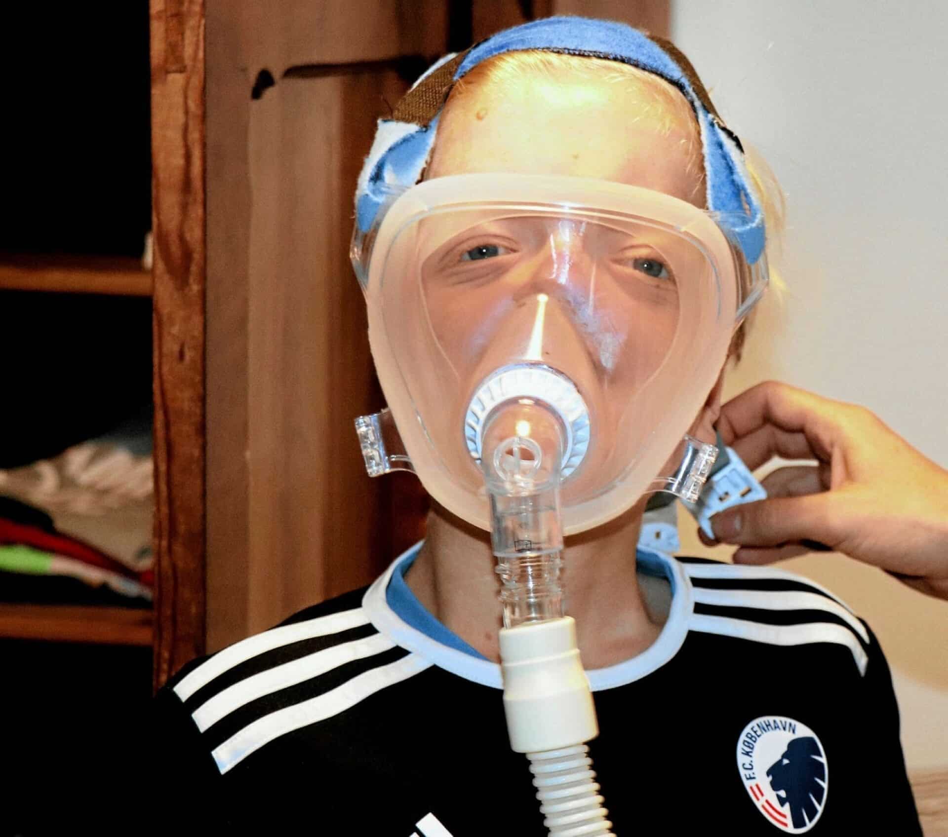 Kraniet kan ikke følge med hjernen | ugeavisen.dk